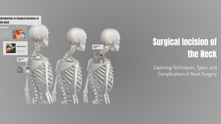 Surgical Incision of the Neck by Taha Heydarie on Prezi