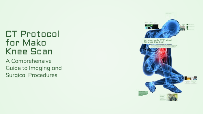 CT Protocol for Mako Knee Scan by Kendall Aloway on Prezi