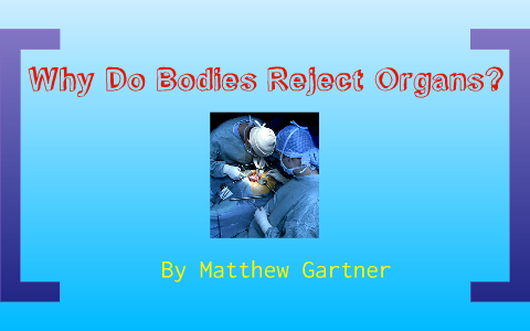 Why Do Bodies Reject Organs? by John Smith on Prezi