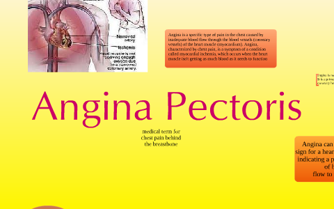 Angina Pectoris by Ariel Jordan on Prezi