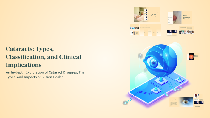 Cataracts: Types, Classification, and Clinical Implications by Dr ...