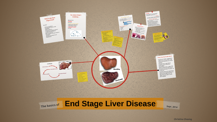 End Stage Liver Disease by Christina Choung on Prezi