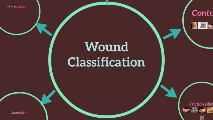 Wound Classification by Spencer H on Prezi