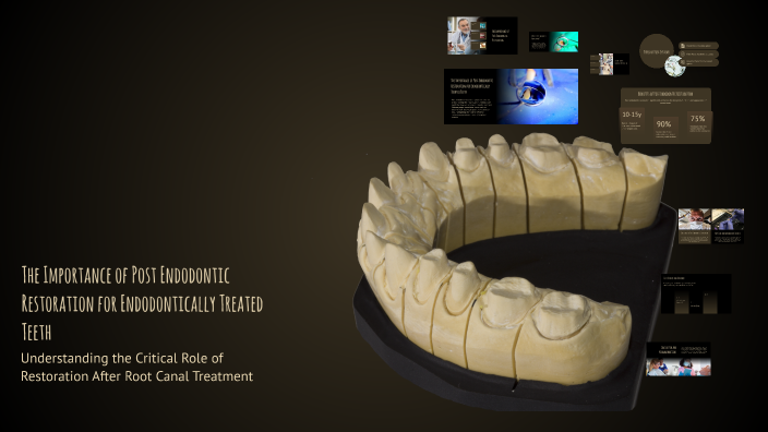 The Importance of Post Endodontic Restoration for Endodontically ...