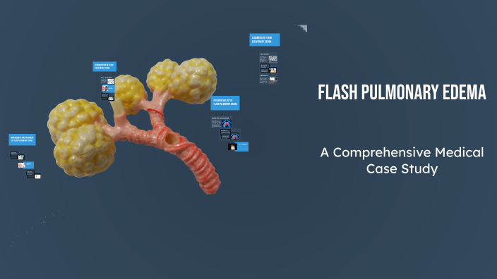 Flash Pulmonary Edema by Ryan Weidman on Prezi