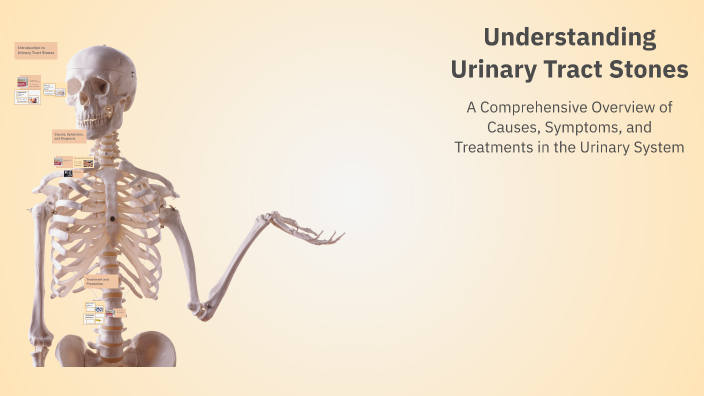 Understanding Urinary Tract Stones by Maria Ica seda on Prezi