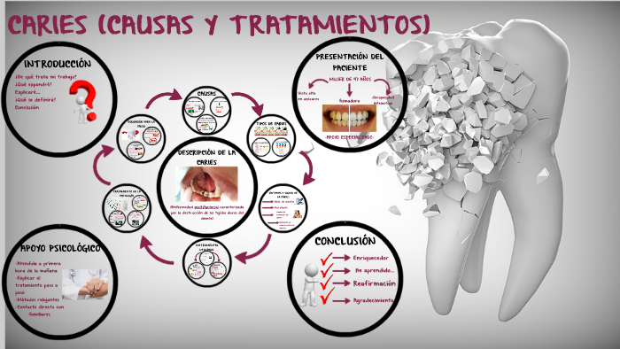 CARIES (CAUSAS Y TRATAMIENTOS) by bianca dama on Prezi