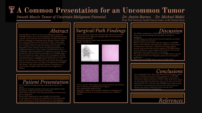 STUMP Tumor by Austin Barnes on Prezi