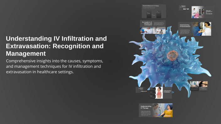 Understanding IV Infiltration and Extravasation: Recognition and ...