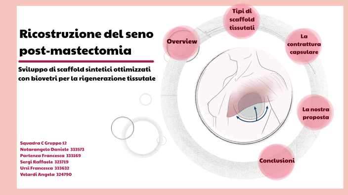 Ricostruzione del seno post mastectomia by Daniele Notarangelo on Prezi