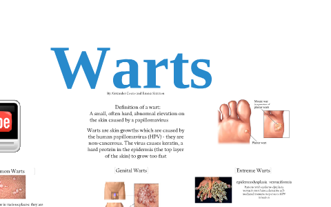 Warts! Anatomy & Physiology Honors by emma stratton on Prezi