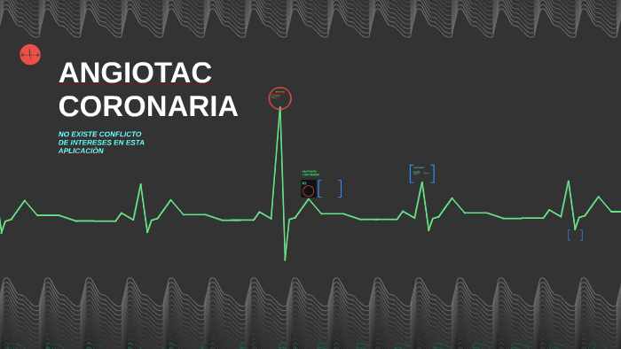 ANGIOTAC CORONARIA by SANDRA RAMON on Prezi