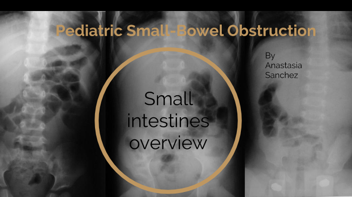 Pediatric Small-Bowel Obstruction by Anastasia David on Prezi
