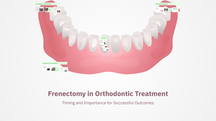 Frenectomy in Orthodontic Treatment by kimia zonouzi on Prezi