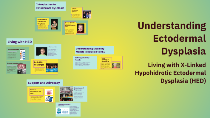Understanding Ectodermal Dysplasia By Alex Quintanar On Prezi