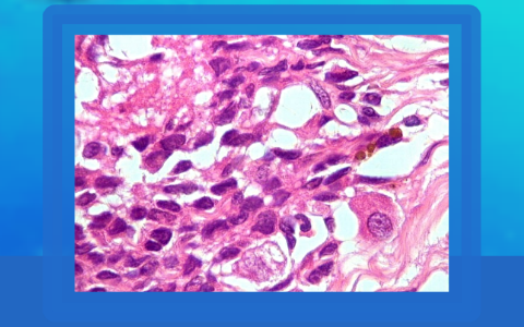 AVALIAÇÃO DO POTENCIAL OSTEOGÊNICO DE DOIS TIPOS DE CHALCONA by Rafa O ...