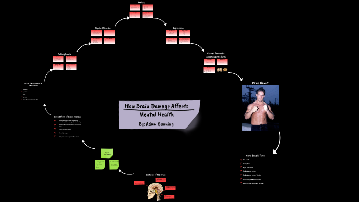 Brain Damage by Adam Gunning on Prezi