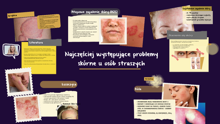 Most Common Skin Issues in Elderly People by Magdalena Czubak on Prezi