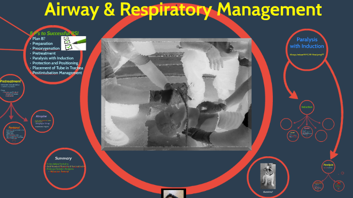 Emergency Airway Management by Ty Vassil on Prezi