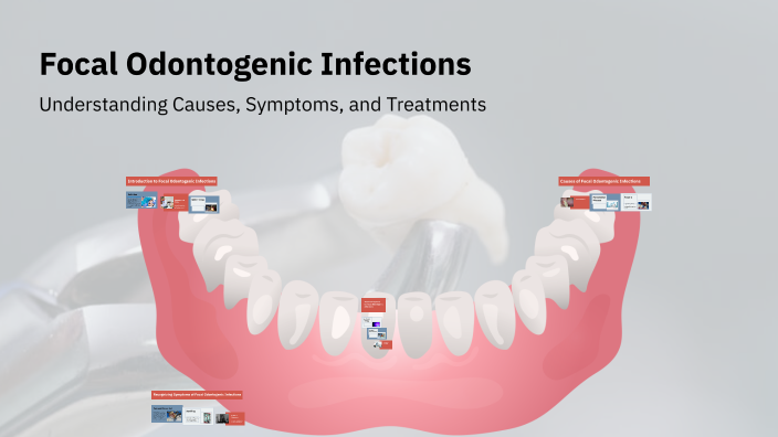 Focal Odontogenic Infections by Ayat Bakerová on Prezi