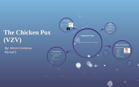 The Chicken Pox By Mitzin Contreras On Prezi