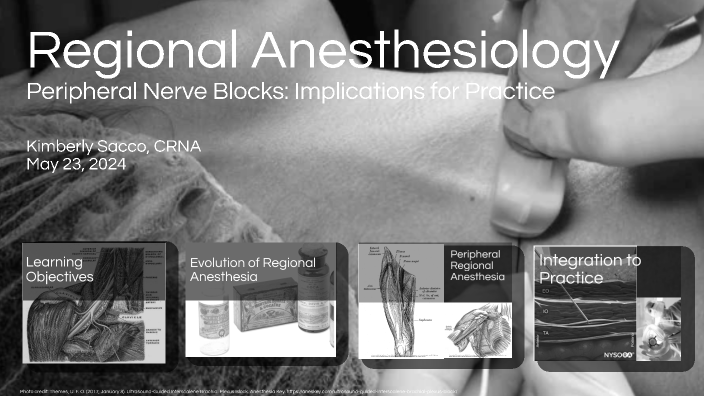 Regional Anesthesia by Kimberly Sacco on Prezi