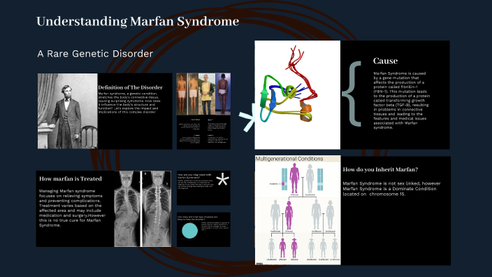 Understanding Marfan Syndrome by Adrian Nelson on Prezi