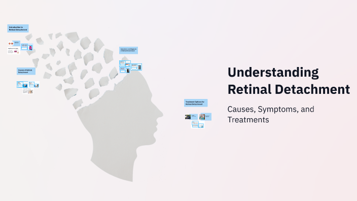 Understanding Retinal Detachment by Robert on Prezi