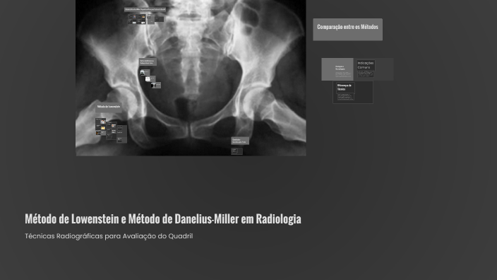 Método de Lowenstein e Método de Danelius-Miller em Radiologia by Pedro ...