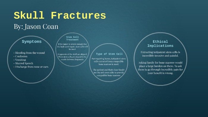 Skull Fracture by Jason Coan on Prezi