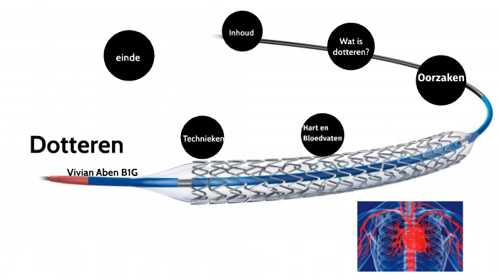 Dotteren by Vivian Aben on Prezi