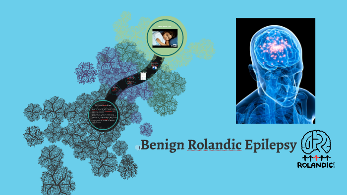 Benign Rolandic Epilepsy by urooj ahmad on Prezi