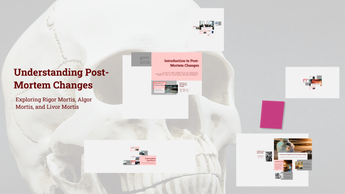 Understanding Post-Mortem Changes: Rigor, Algor, and Livor Mortis by ...