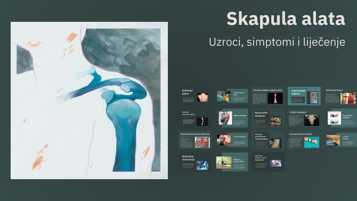 Scapula alata by Lana T on Prezi
