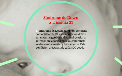 Sindrome de Down o Trisomia 21 by Wendy Amagua on Prezi
