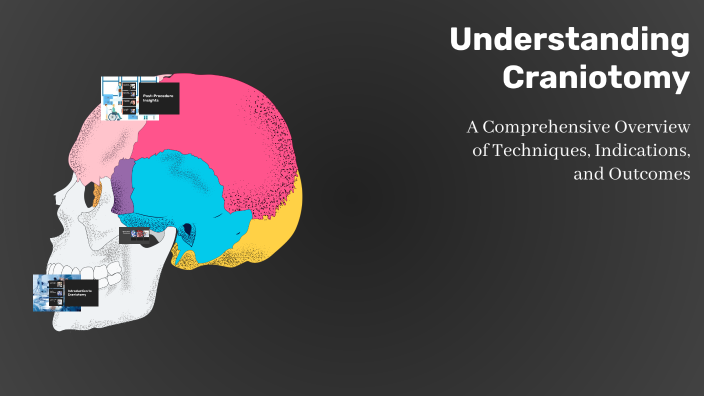 Understanding Craniotomy by afiqah azman on Prezi