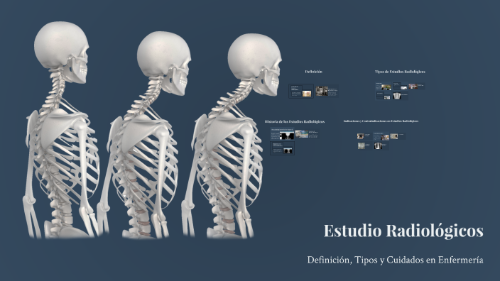 Estudio radiológicos by Sergio Ushiñahua on Prezi