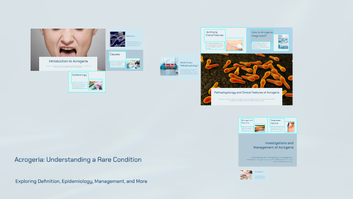 Acrogeria: Understanding a Rare Condition by Muhammad Ahmad Arshad on Prezi