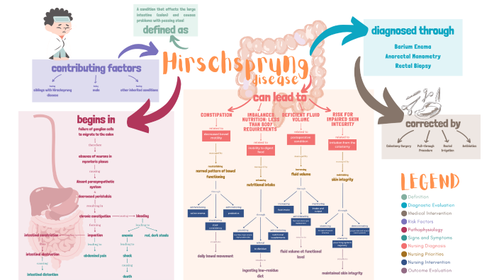 Hirschsprung Disease by Magi Epiphany Vasquez on Prezi
