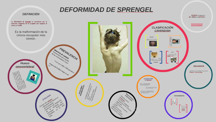 DEFORMIDAD DE SPRENGEL by Alma Loaiza Pliego on Prezi