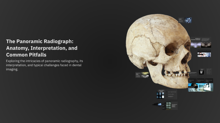 The Panoramic Radiograph: Anatomy, Interpretation, and Common Pitfalls ...