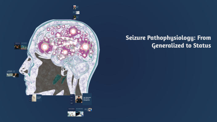 Seizure Pathophysiology: From Generalized to Status by Brett Ryan on Prezi