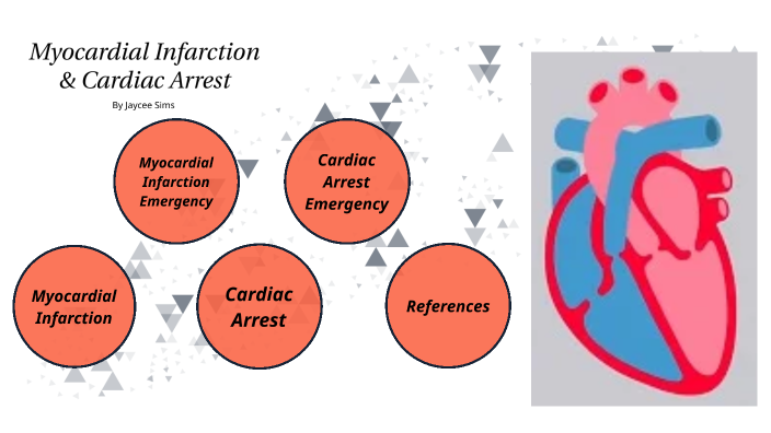 Myocardial Infarction/Cardiac Arrest by Jaycee Sims on Prezi