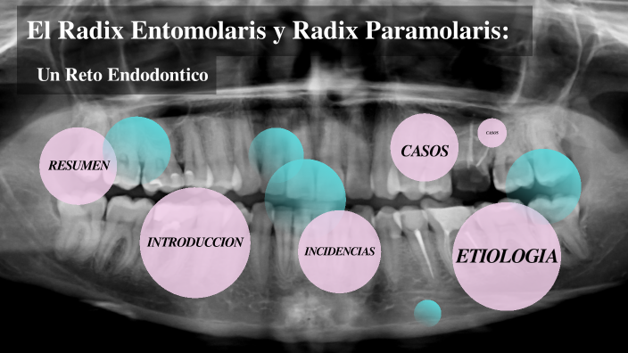 El Radix Entomolaris y el Radix Paramolaris: Un reto Endodontico by ...