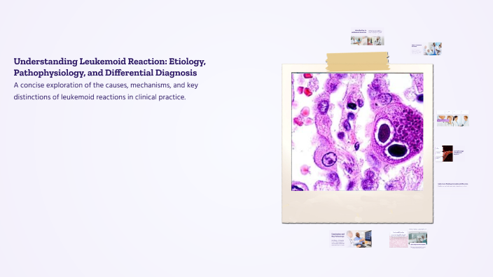 Understanding Leukemoid Reaction: Etiology, Pathophysiology, and ...