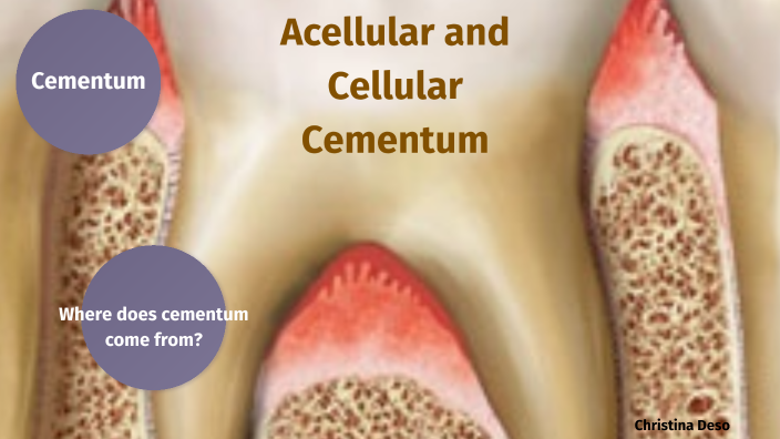 Acellular and Cellular Cementum by Christina Deso on Prezi