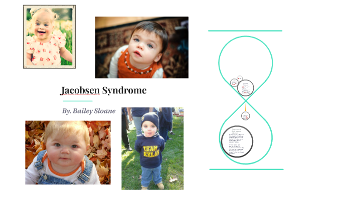 Jacobsen Syndrome by bailey sloane on Prezi