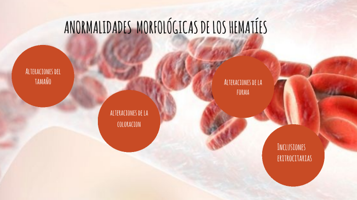 ANORMALIDADES MORFOLÓGICAS DE LOS HEMATÍES by tania chacha correa on Prezi