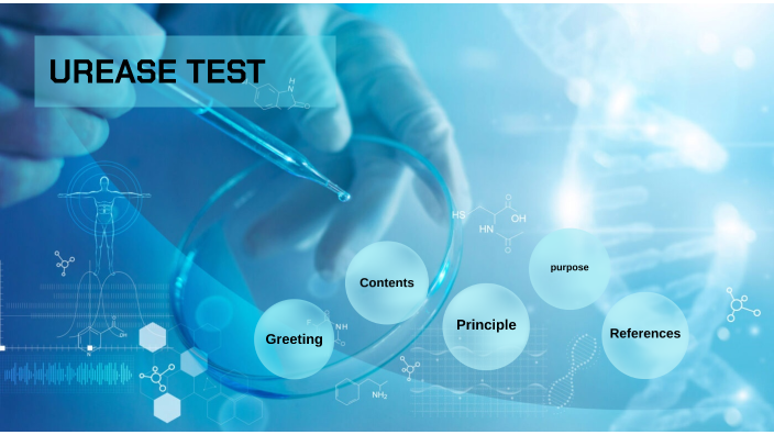 urease test by Lu na on Prezi