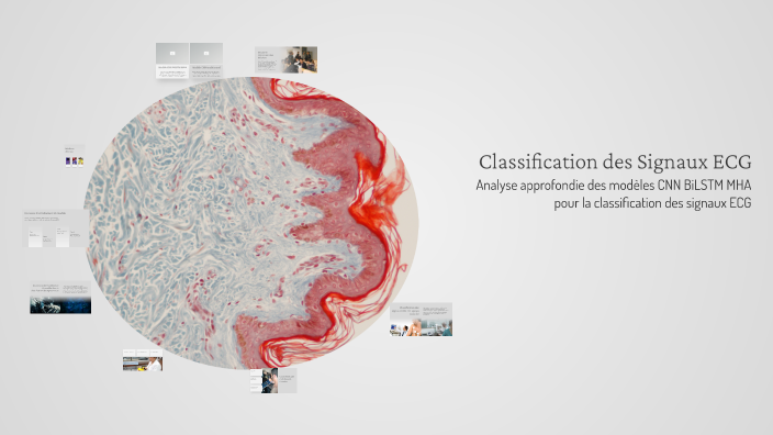 Classification des Signaux ECG by nacer abh on Prezi